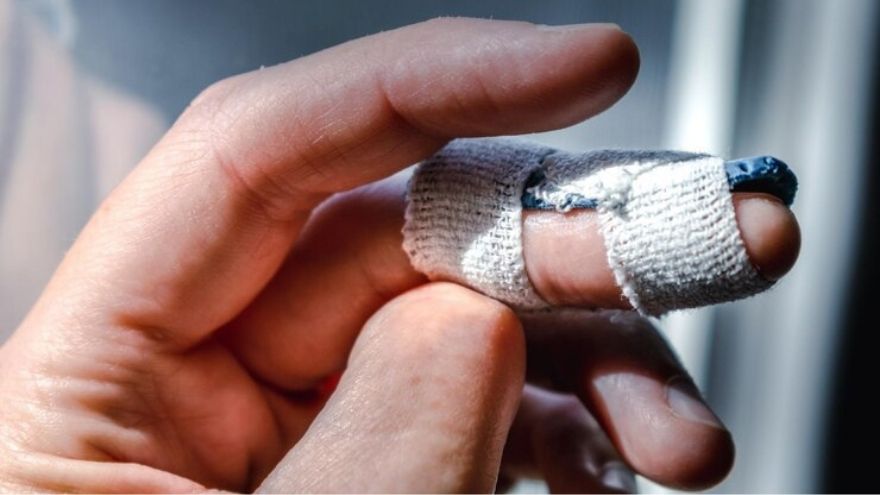 Atel Nedir? Ne için ve Nasıl Kullanılır? - Ankara'dan Son Dakika ...