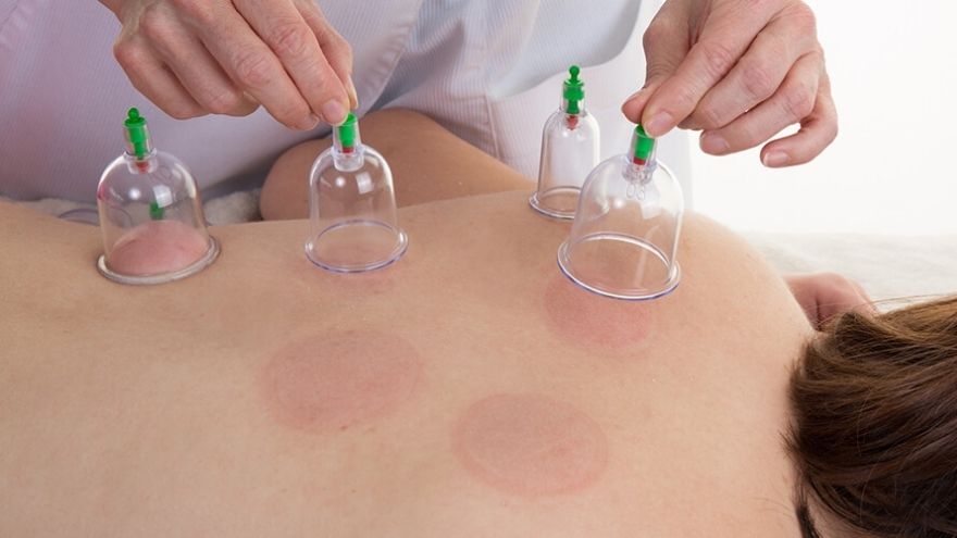 Hacamat Nedir? Hacamat Nasıl Yapılır ve Faydaları Nelerdir? - Ankara'dan Son Dakika; Ekonomi ...